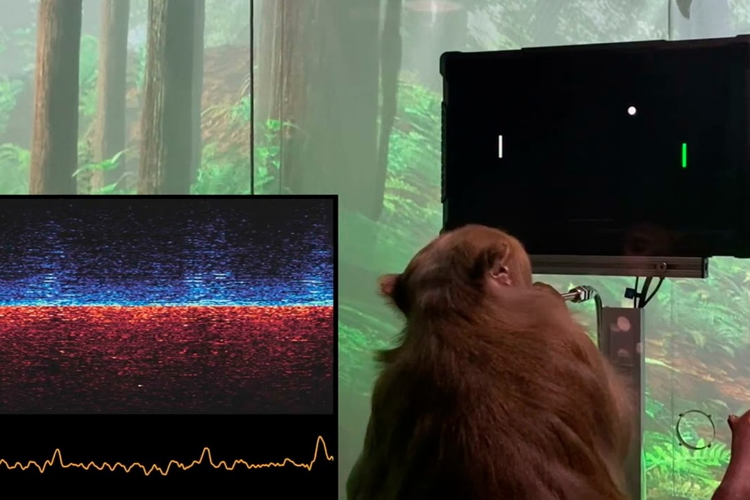 Elon Musk 主理之 Neuralink 展示獼猴僅用腦波即可遊玩經典電玩《Pong》 | Hypebeast