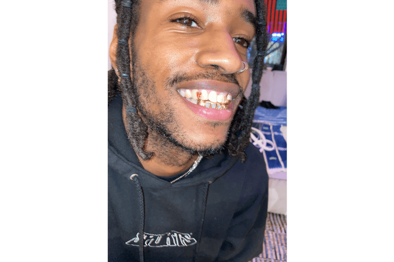 Modern Matter, How to Invest in Grillz | Hypebeast