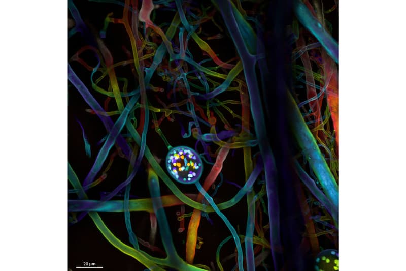 Nikon 2020 Small World Photo Winners | Hypebeast