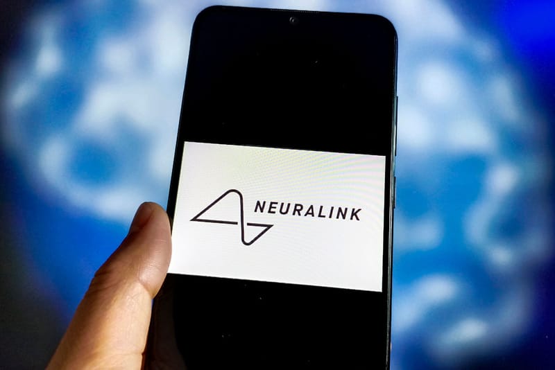 Elon Musk Neuralink First Brain Implant Surgery Ready | Hypebeast