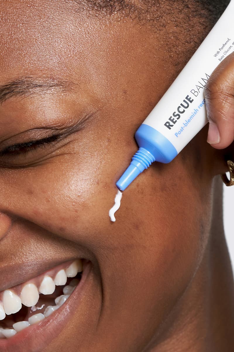 Hero Cosmetics Acne Rescue Balm Release | Hypebae