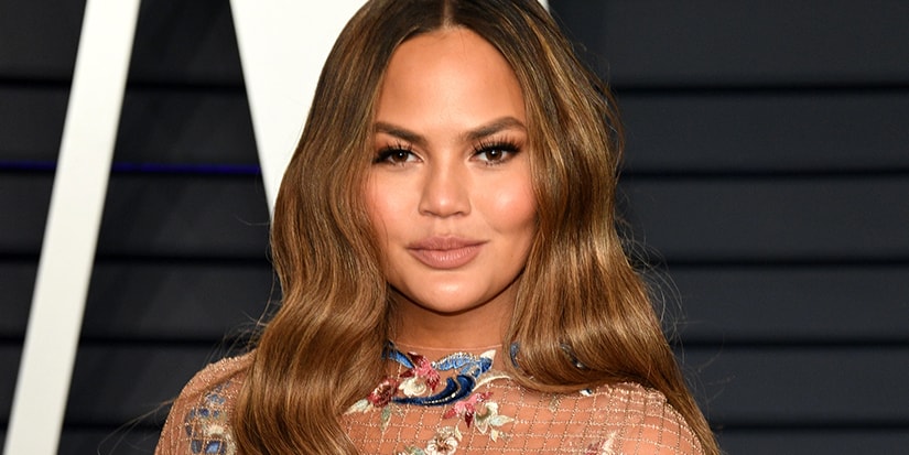 Chrissy Teigen Reveals Natural Hair Length | Hypebae