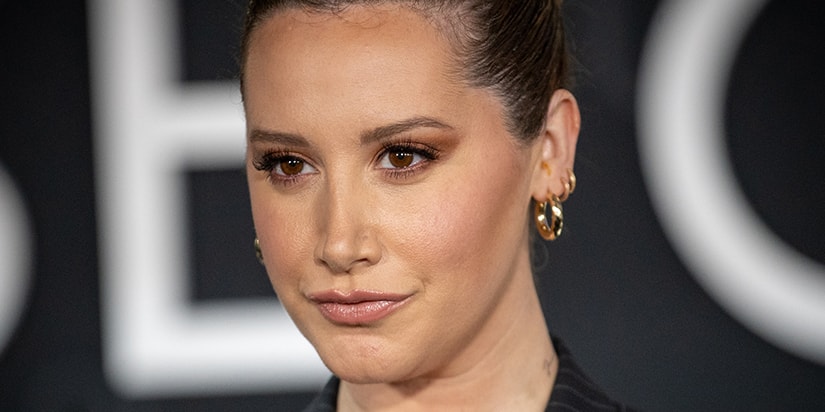 Ashley Tisdale Shares Alopecia Diagnosis | Hypebae