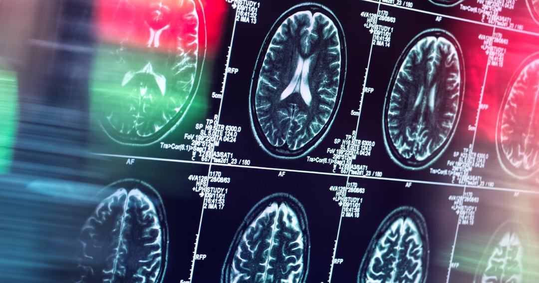 사람의 생각을 문장으로 구현하는 AI 모델이 나왔다 | Hypebeast.KR | 하입비스트